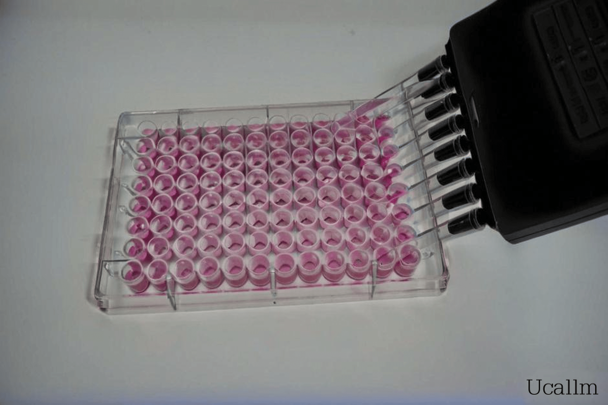 How to Efficiently Count Bacterial Colonies After Bacterial Culture in ...