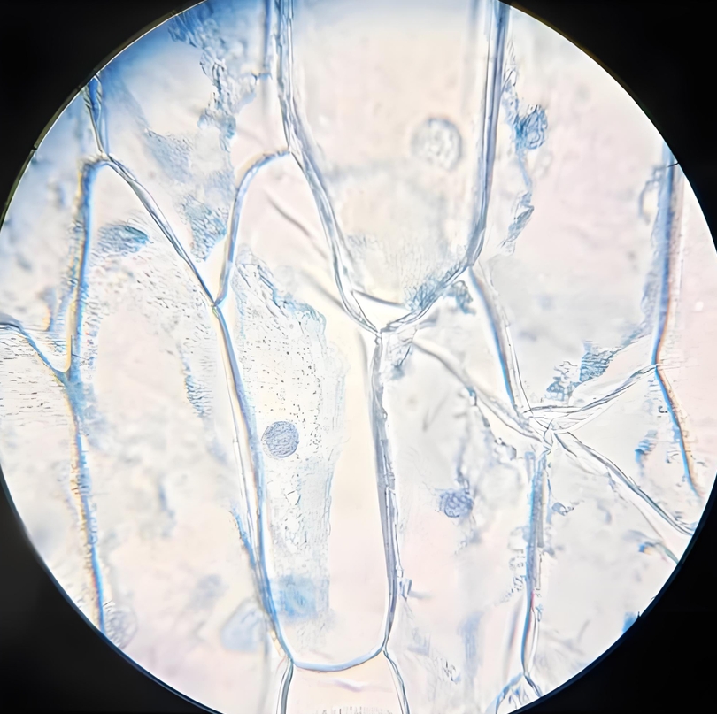 Bacterial vs Human Cell: Key Differences Explained - Ucallmlabs