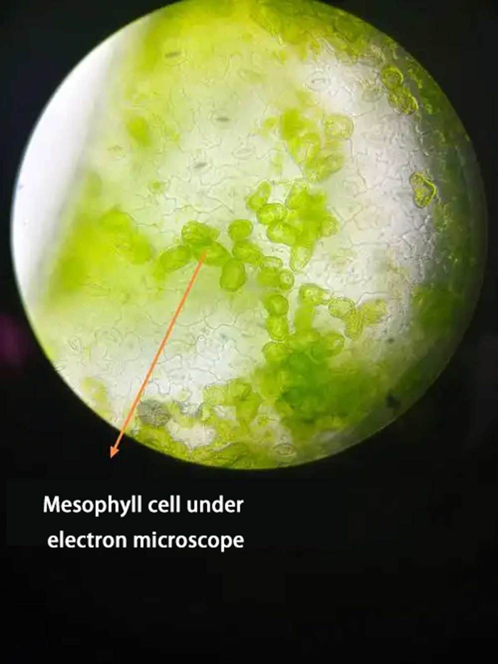 Observation of Chloroplast Structure in Plant Cell under Electron ...