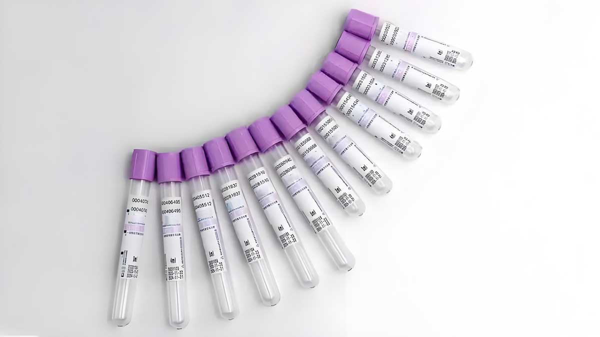 what is the lavender blood tube used for